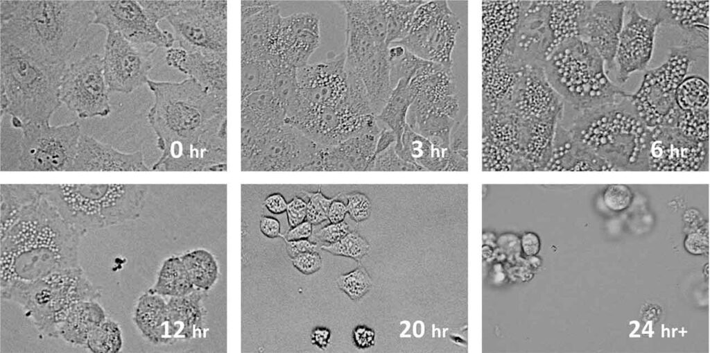 Orbital Oncology: 3D Cell Cultures in Space Reveal the Secret to ...