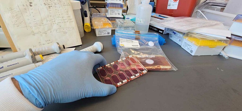 Orbital Oncology: 3D Cell Cultures in Space Reveal the Secret to ...