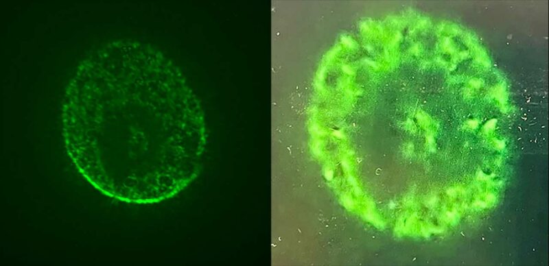 From Viral Villain to Gene Therapy Hero: Assembling 3D Brain Organoids ...